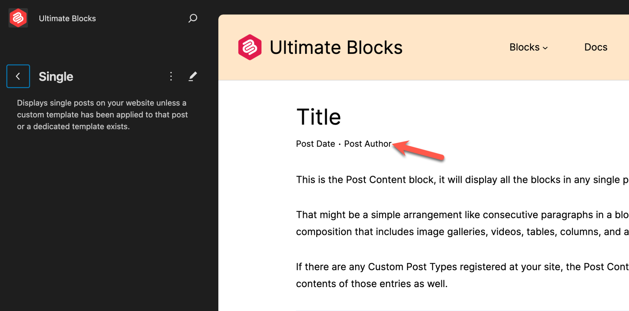 How To Hide Author Name In WordPress Posts how-to-hide-author-name-in-wordpress-posts